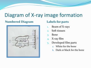X-Rays and their Medical Use.pptx
