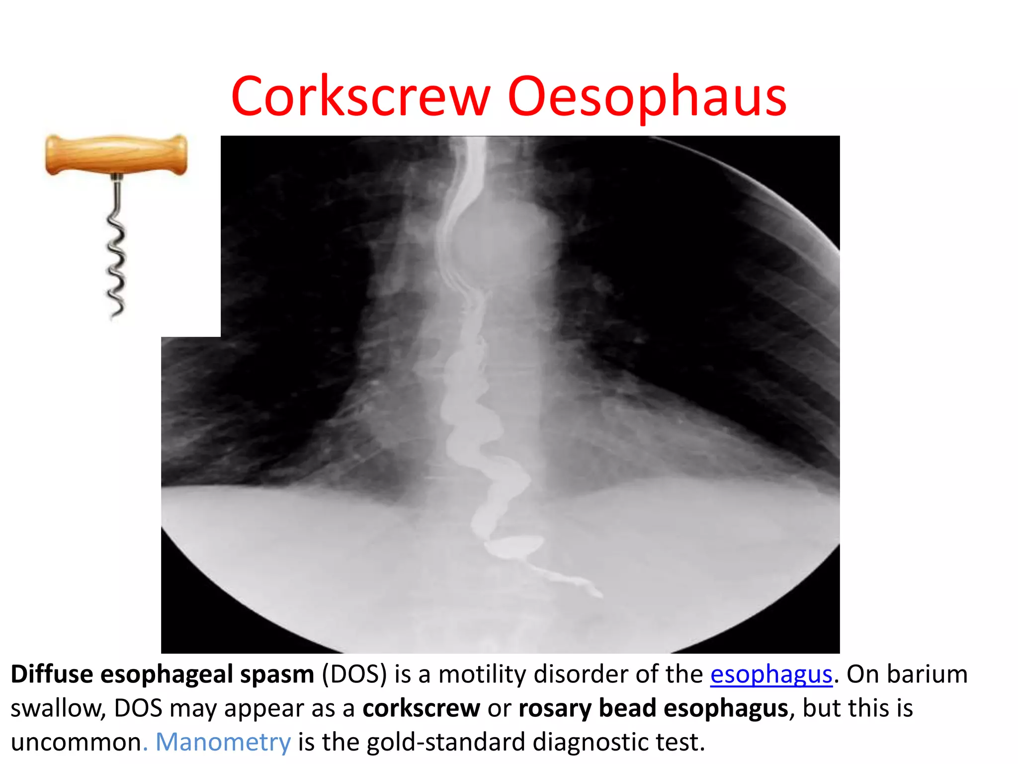 X ray signs of abdomen | PPTX