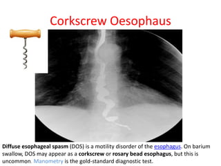 X ray signs of abdomen | PPTX