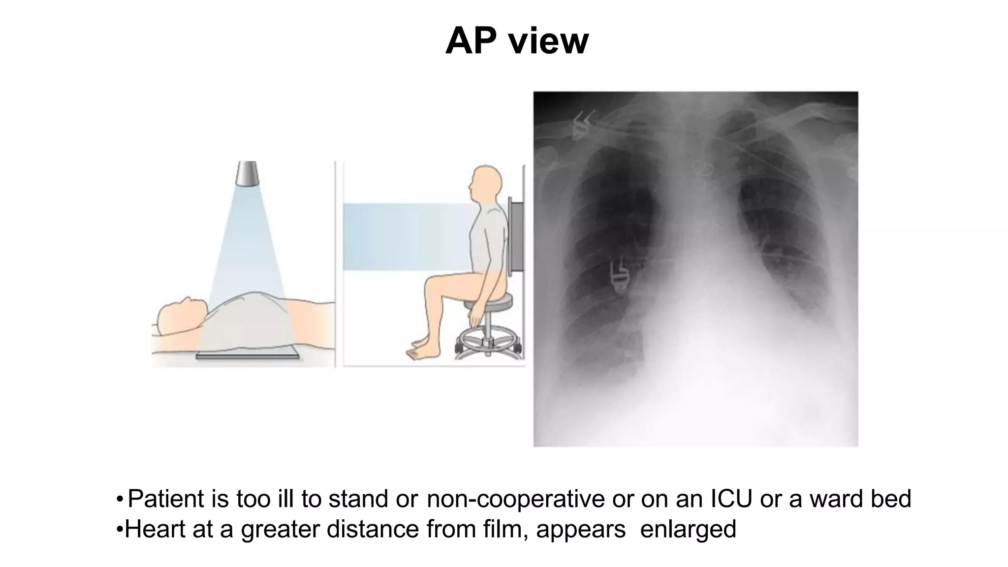 X rays in surgery for undergraduates Dr Dev Taneja-06.06.2021