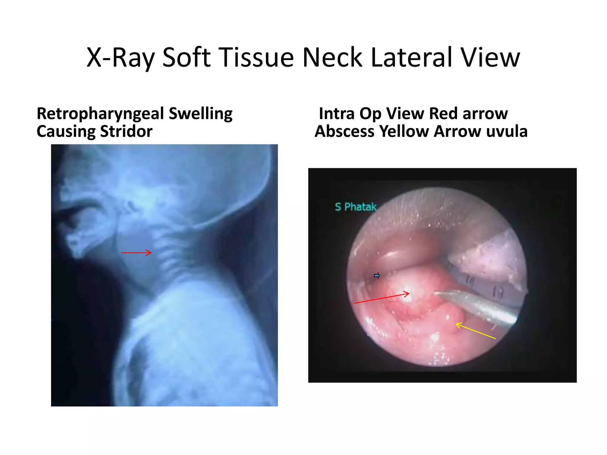 X ray soft tissue neck valuable economic tool | PPTX