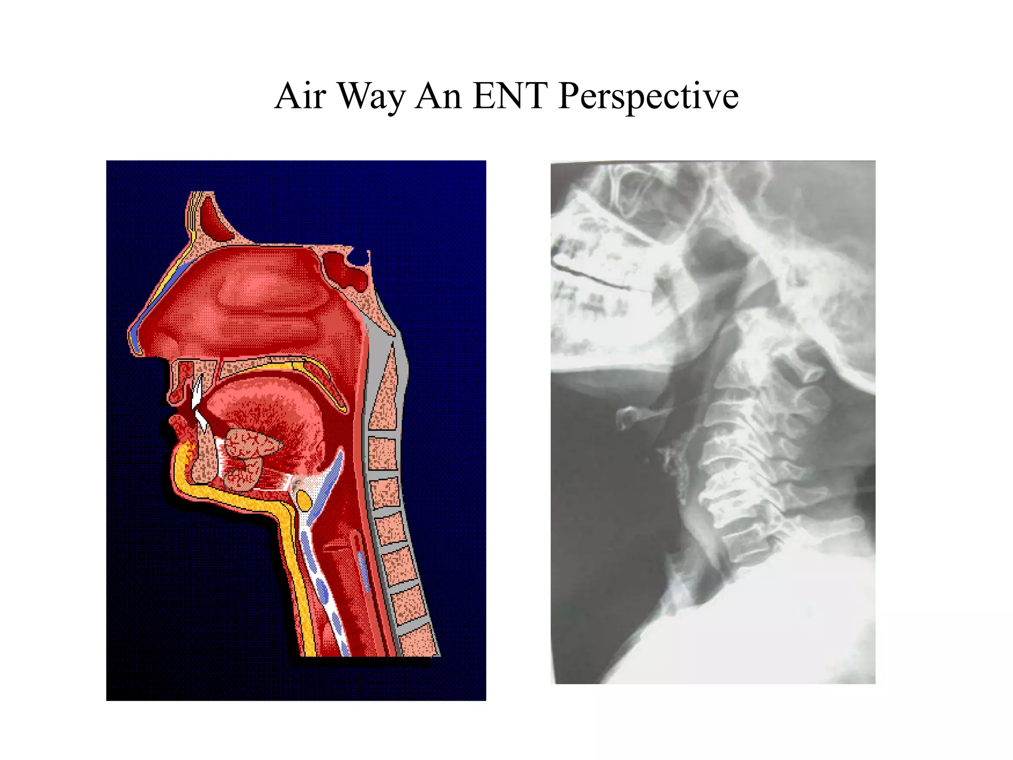 X ray soft tissue neck valuable economic tool | PPTX