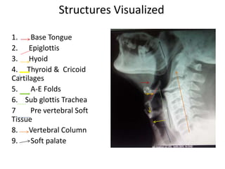 Neck Anatomy Lateral Radiography