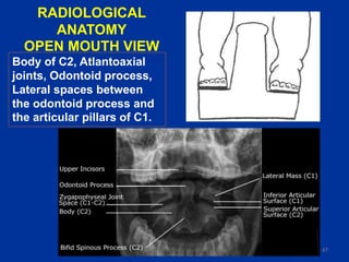 X-ray spine | PPTX