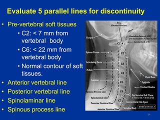 X-ray spine | PPTX