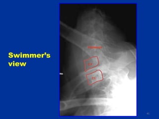 Swimmers View X Ray