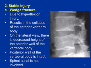 Broken Vertebrae X Ray