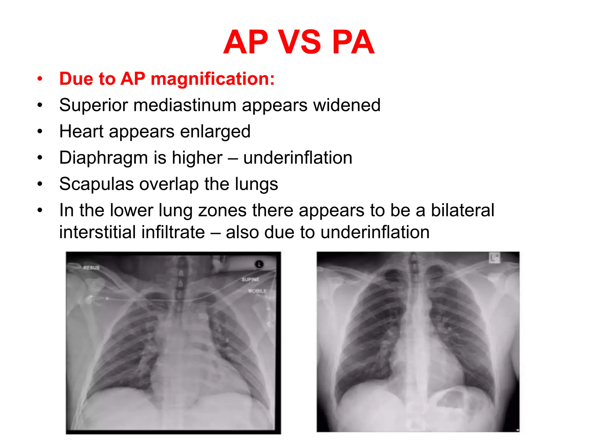 CHEST X-RAYS QUALITY,,,,,,,,,,,,,,,, pptx | PPTX