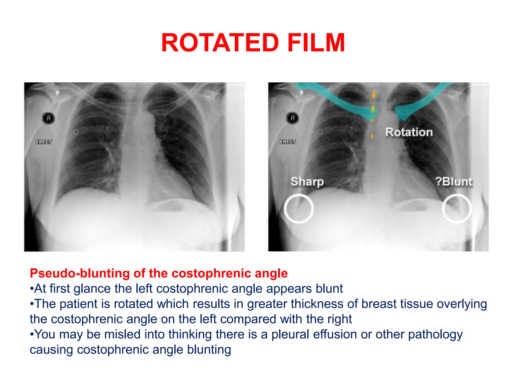 CHEST X-RAYS QUALITY,,,,,,,,,,,,,,,, pptx | PPTX