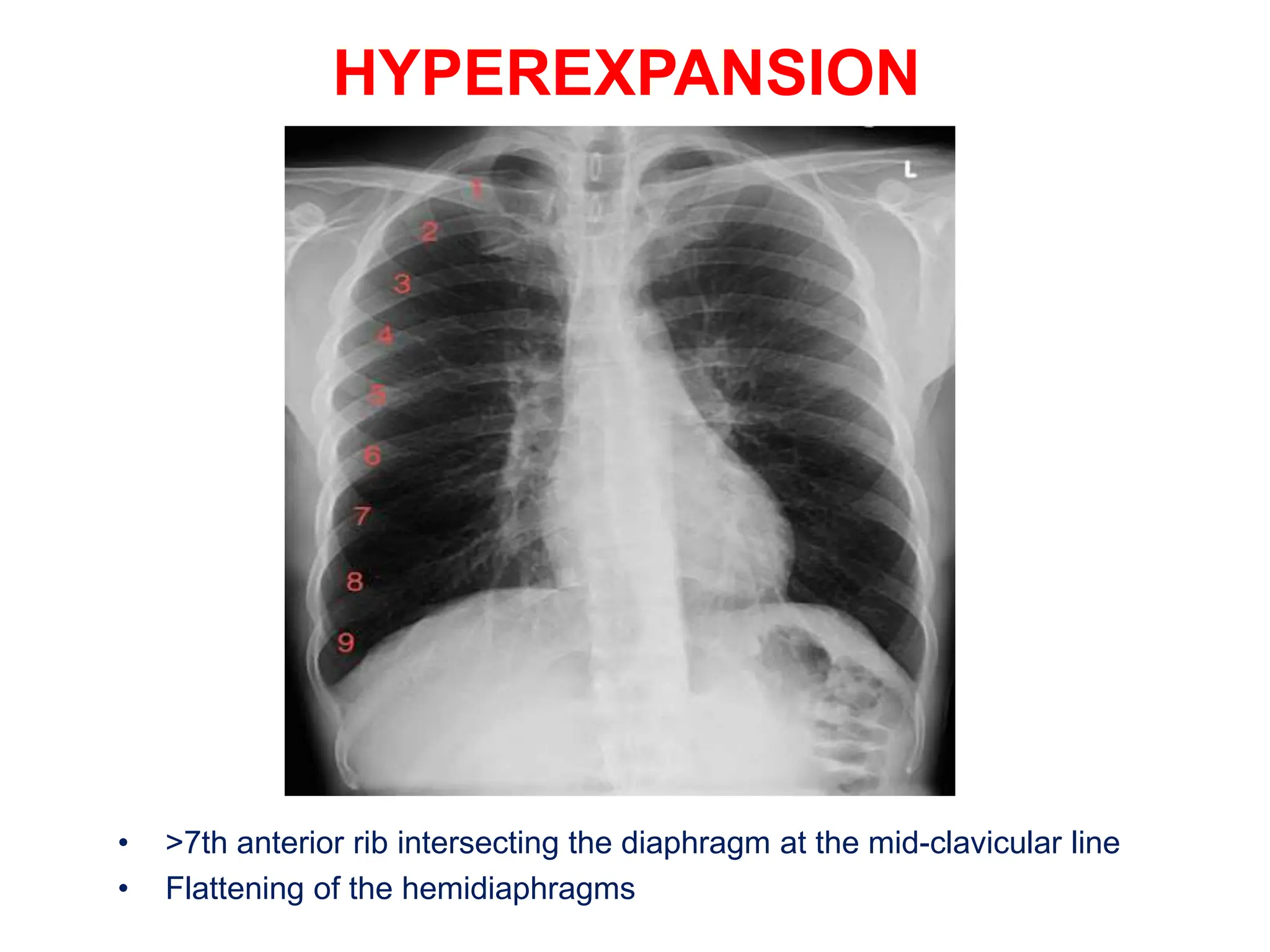 CHEST X-RAYS QUALITY,,,,,,,,,,,,,,,, pptx | PPTX