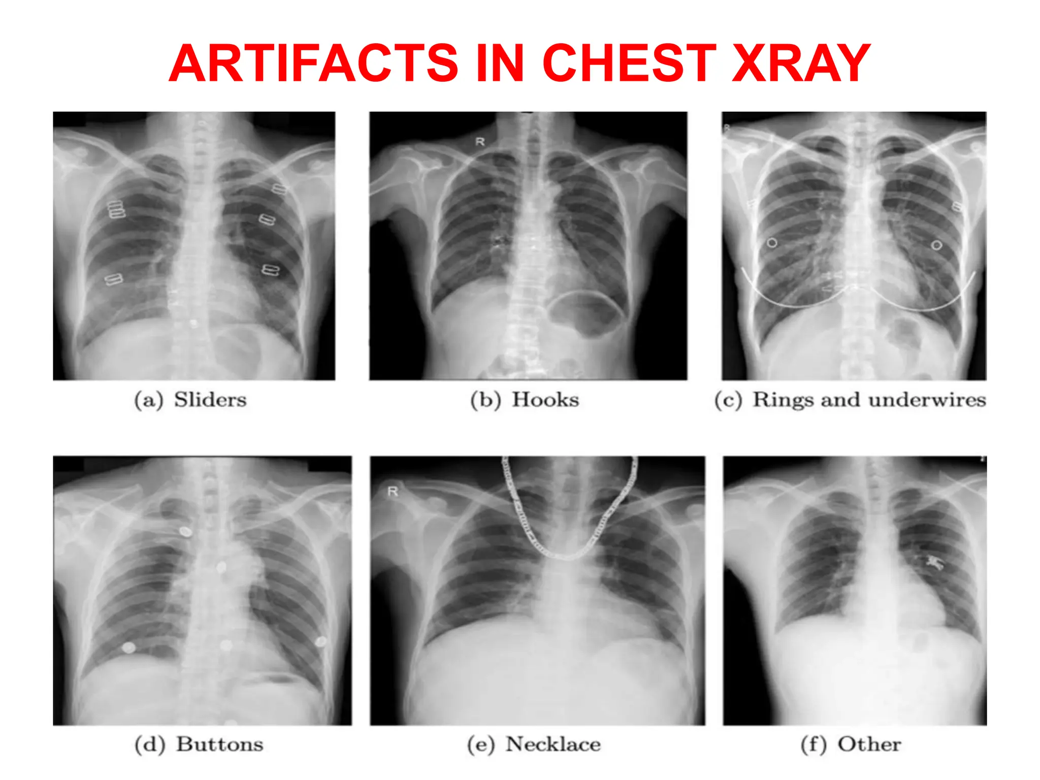 CHEST X-RAYS QUALITY,,,,,,,,,,,,,,,, pptx | PPTX
