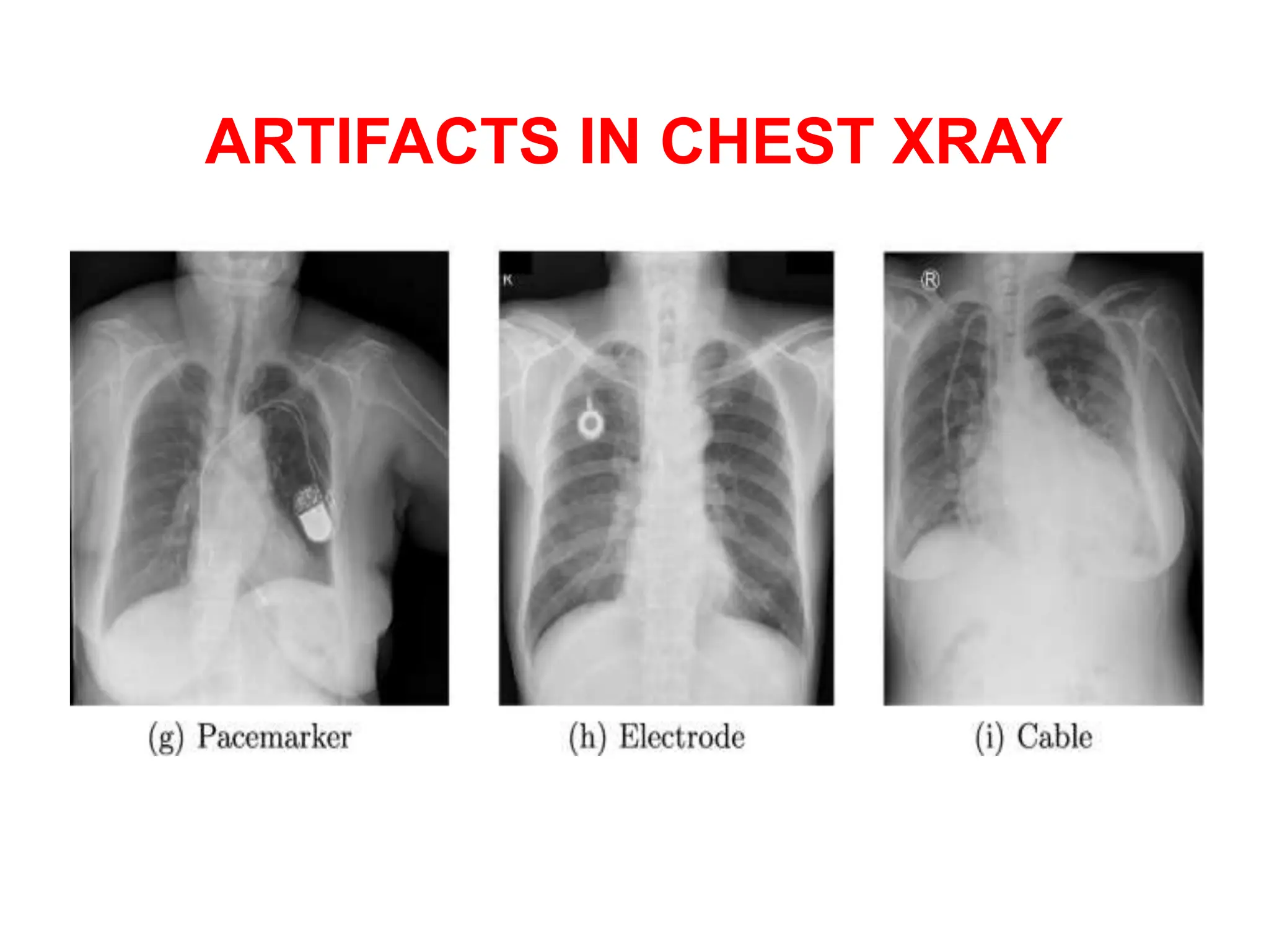 CHEST X-RAYS QUALITY,,,,,,,,,,,,,,,, pptx | PPTX