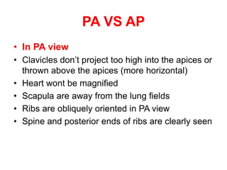 CHEST X-RAYS QUALITY,,,,,,,,,,,,,,,, pptx | PPTX