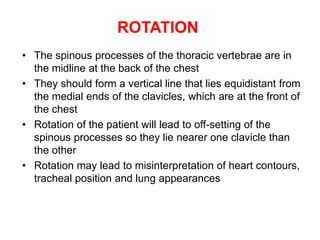 CHEST X-RAYS QUALITY,,,,,,,,,,,,,,,, pptx | PPTX