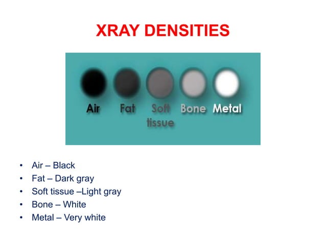 CHEST X-RAYS QUALITY,,,,,,,,,,,,,,,, pptx | PPTX | Lung and Respiratory ...
