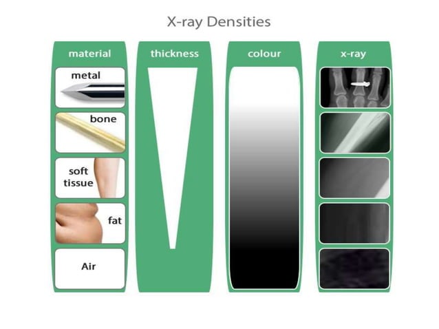 CHEST X-RAYS QUALITY,,,,,,,,,,,,,,,, pptx | PPTX | Lung and Respiratory ...