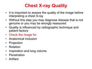 CHEST X-RAYS QUALITY,,,,,,,,,,,,,,,, pptx | PPTX