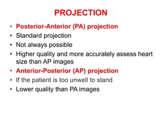 CHEST X-RAYS QUALITY,,,,,,,,,,,,,,,, pptx | PPTX
