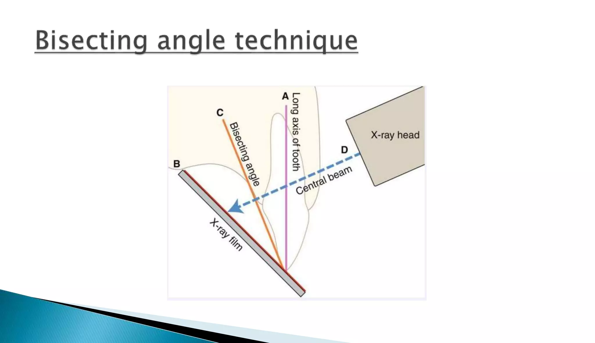 X ray techniques and interpretations | PPTX