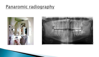 X ray techniques and interpretations | PPTX