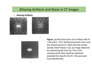 X ray tomography | PPTX