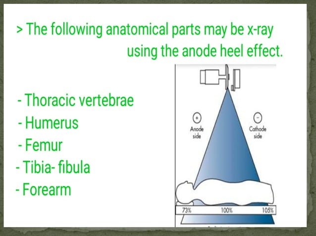 X-Ray Tubes: Types, Construction, Line Focus Principle, and the Heel ...