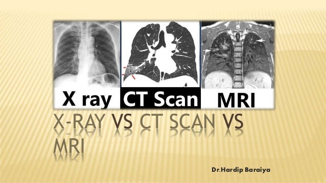X Ray Vs Ct Scan Vs Mripptx