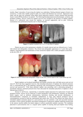Immediate Implants Placed Into Infected Sockets: Clinical Update with 3-Year Follow-Up | PDF ...