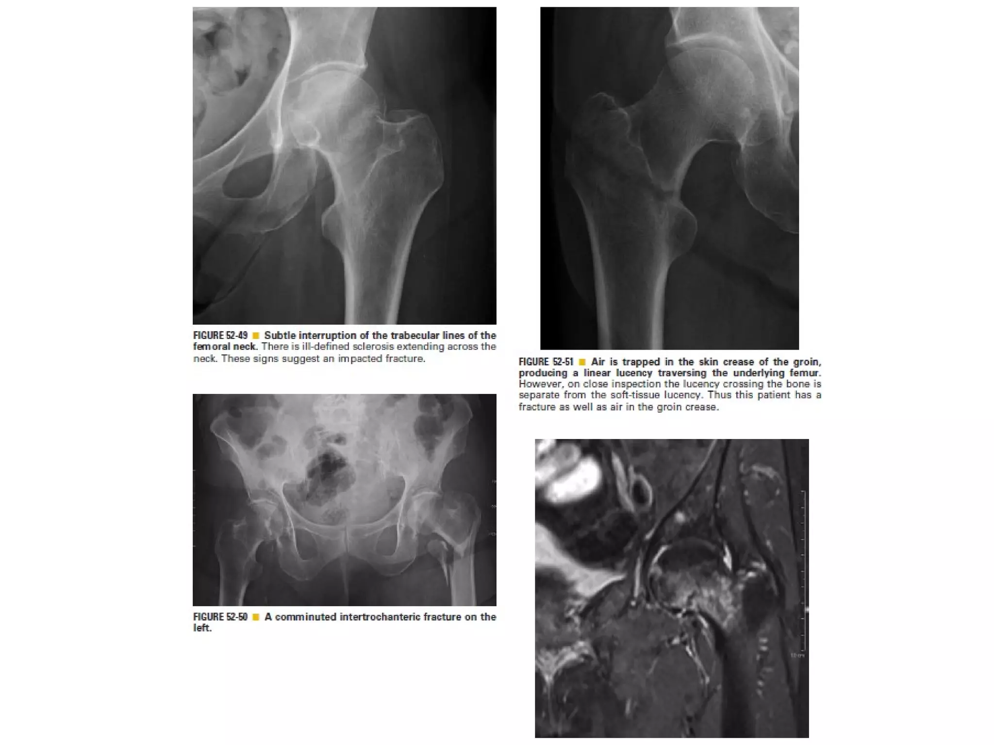 Skeletal trauma | PPT