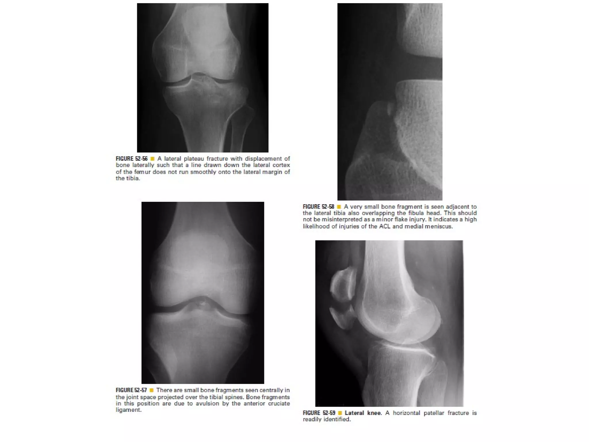 Skeletal trauma | PPT