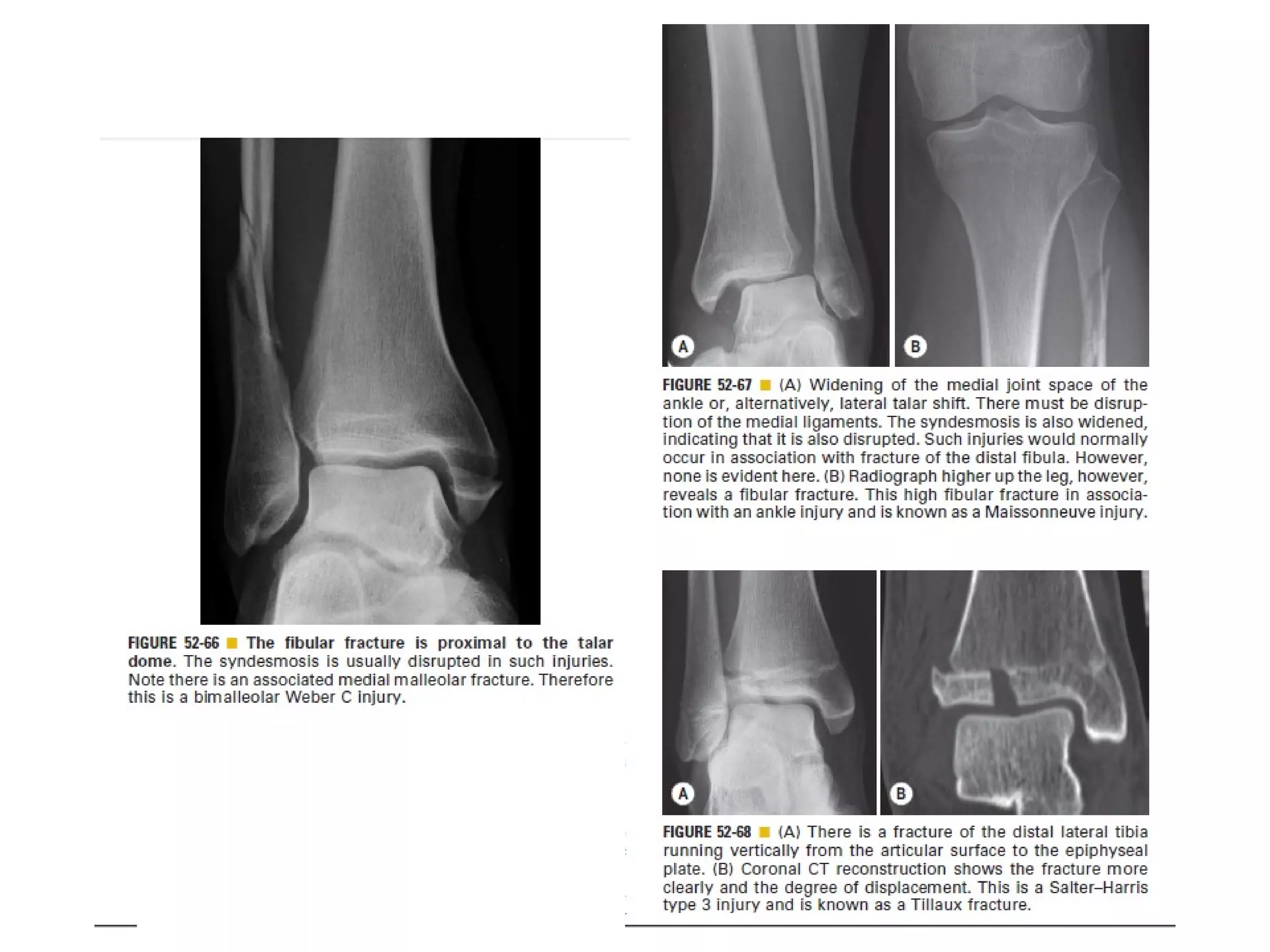 Skeletal trauma | PPT