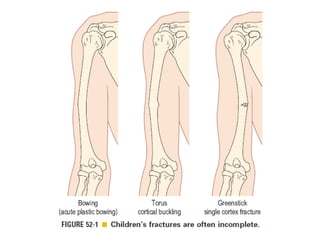 Skeletal trauma | PPT