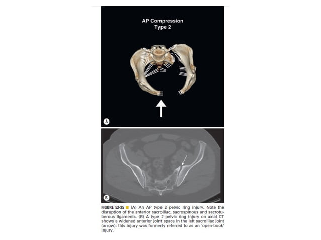 Skeletal trauma | PPT