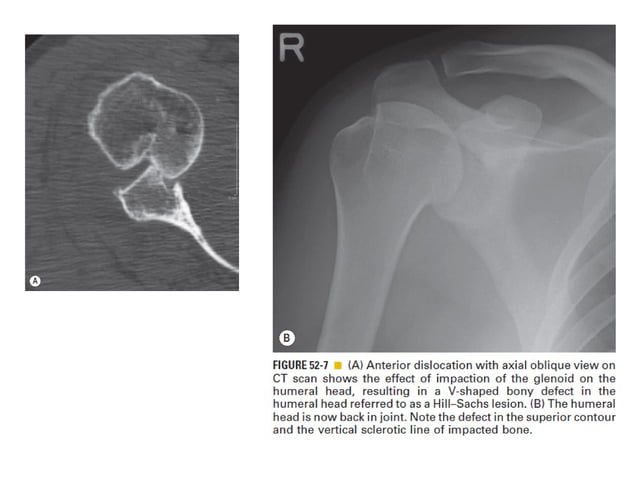 Skeletal trauma | PPT