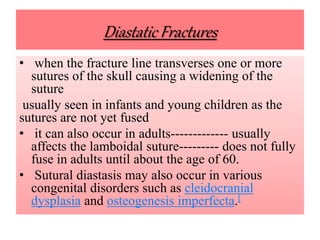 Anatomy of skull fractures | PPT