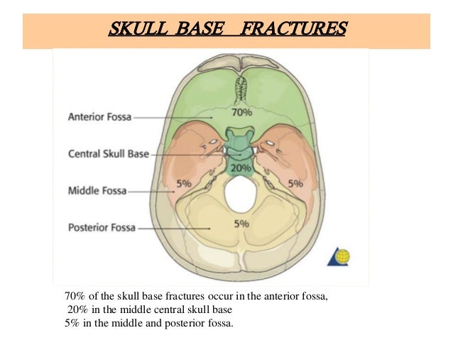 Anatomy of skull fractures
