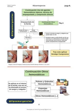 xabcdecontrol-de-hemorragias-tipsemergencias.pdf