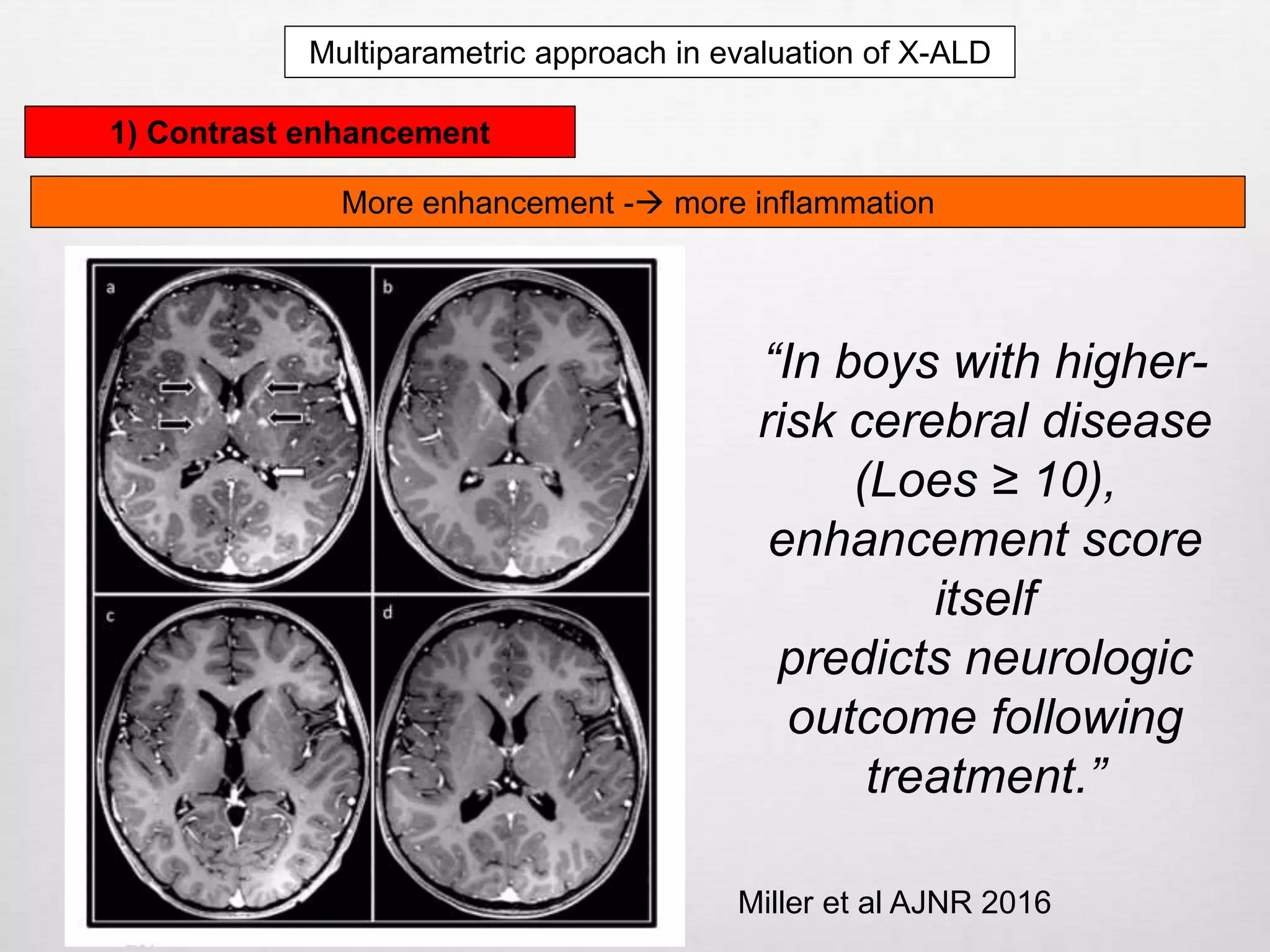 X-linked adrenoleukodystrophy: Radiological assessment | PPTX