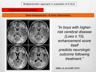 X-linked adrenoleukodystrophy: Radiological assessment | PPTX