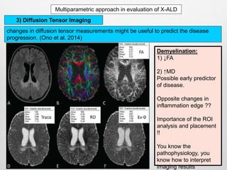 Adrenoleukodystrophy