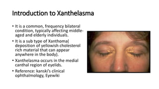Xanthelasma Xanthoma Medical Meaning And Pronunciation Xanthoma ...