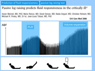 Assessment of fluid responsiveness Beyond PPV | PPTX | Heart and ...