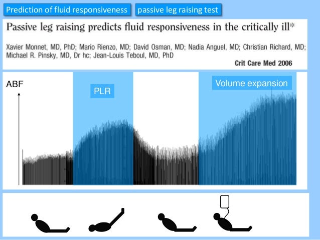 Assessment of fluid responsiveness Beyond PPV