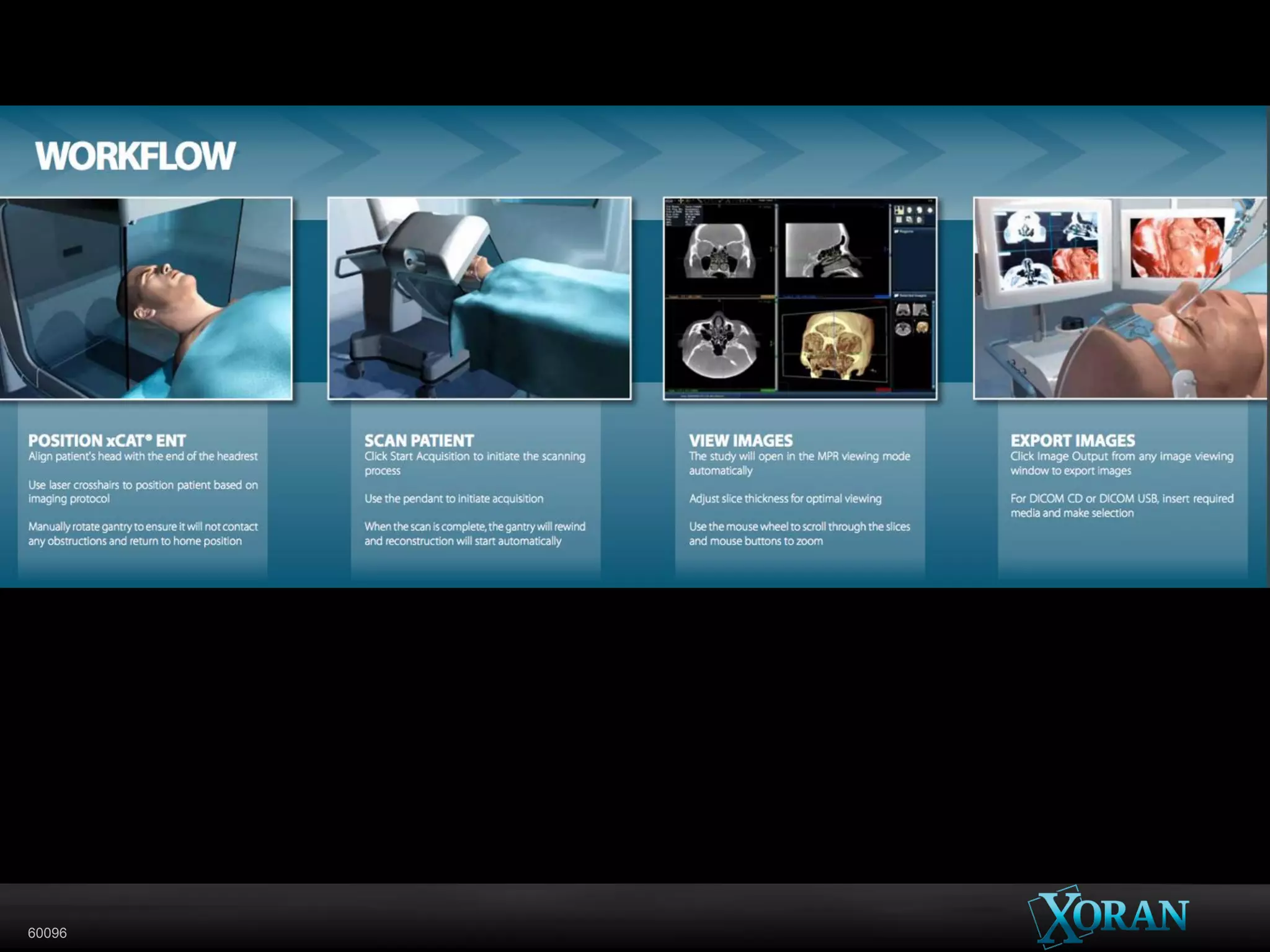 Xoran's xCAT - high resolution low dose head CT | PDF