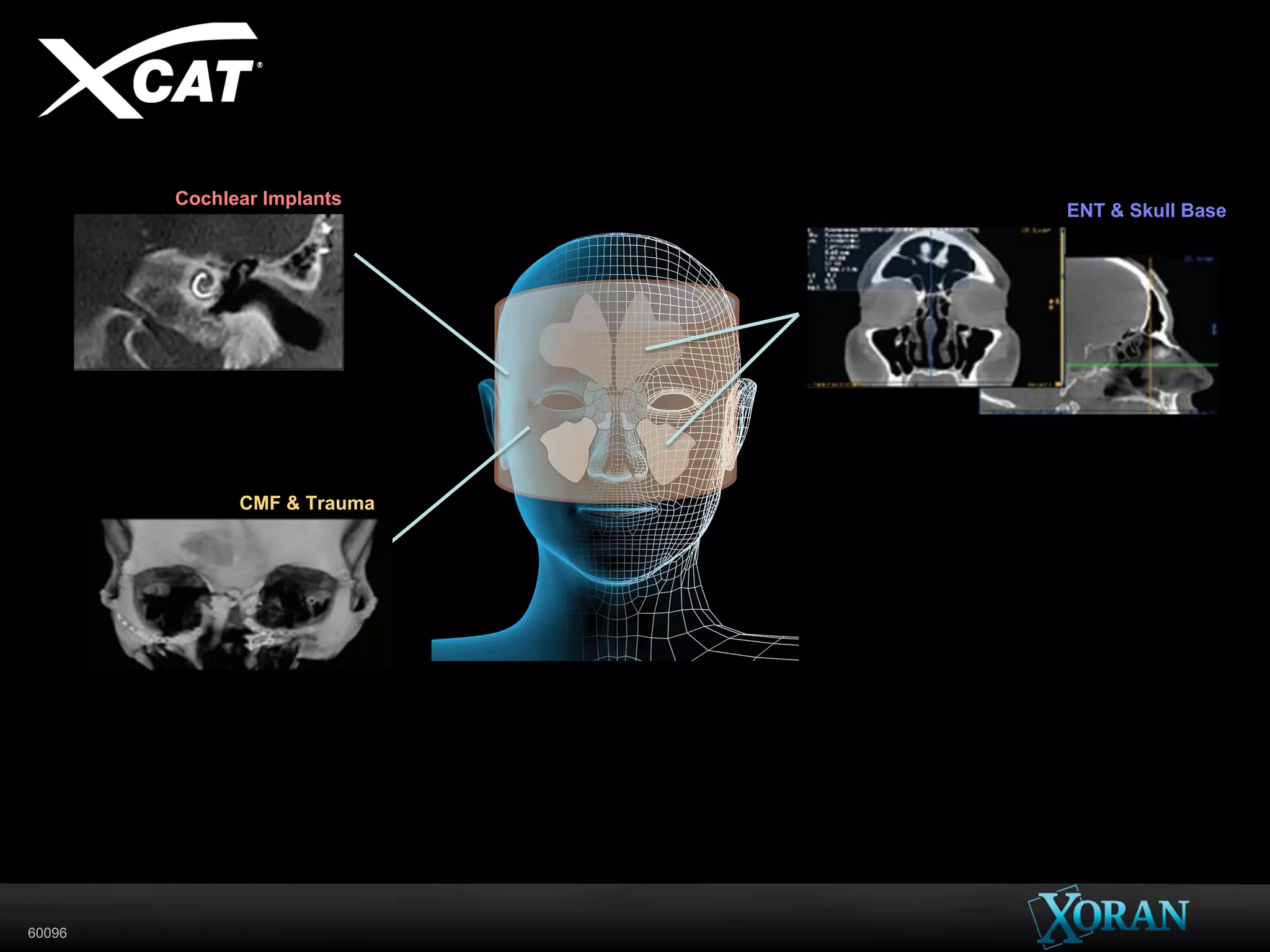 Xoran's xCAT - high resolution low dose head CT | PDF