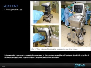 Xoran's xCAT - high resolution low dose head CT | PDF