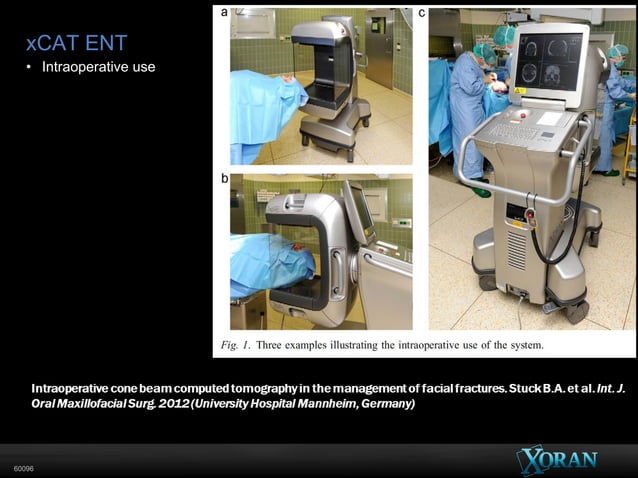 Xoran's xCAT - high resolution low dose head CT | PDF