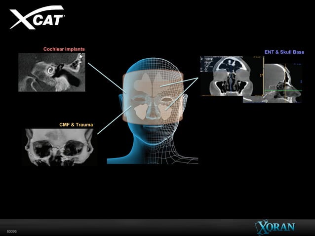 Xoran's xCAT - high resolution low dose head CT | PDF