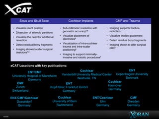 Xoran's xCAT - high resolution low dose head CT | PDF