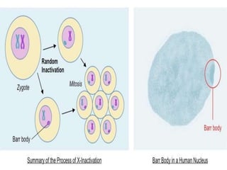 X chromosome inactivation | PPTX